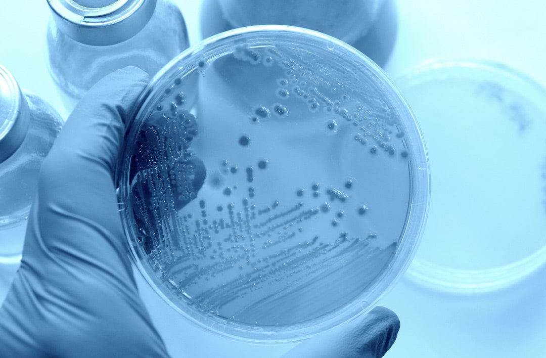 Microbiology & Disposables - Arete Ltd.